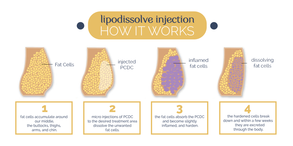 肝得健 Lipodissolve Injection 注射劑 產品說明 - 肝得健 L.Injection - 微整注射美學 - 削骨.隆鼻 ...
